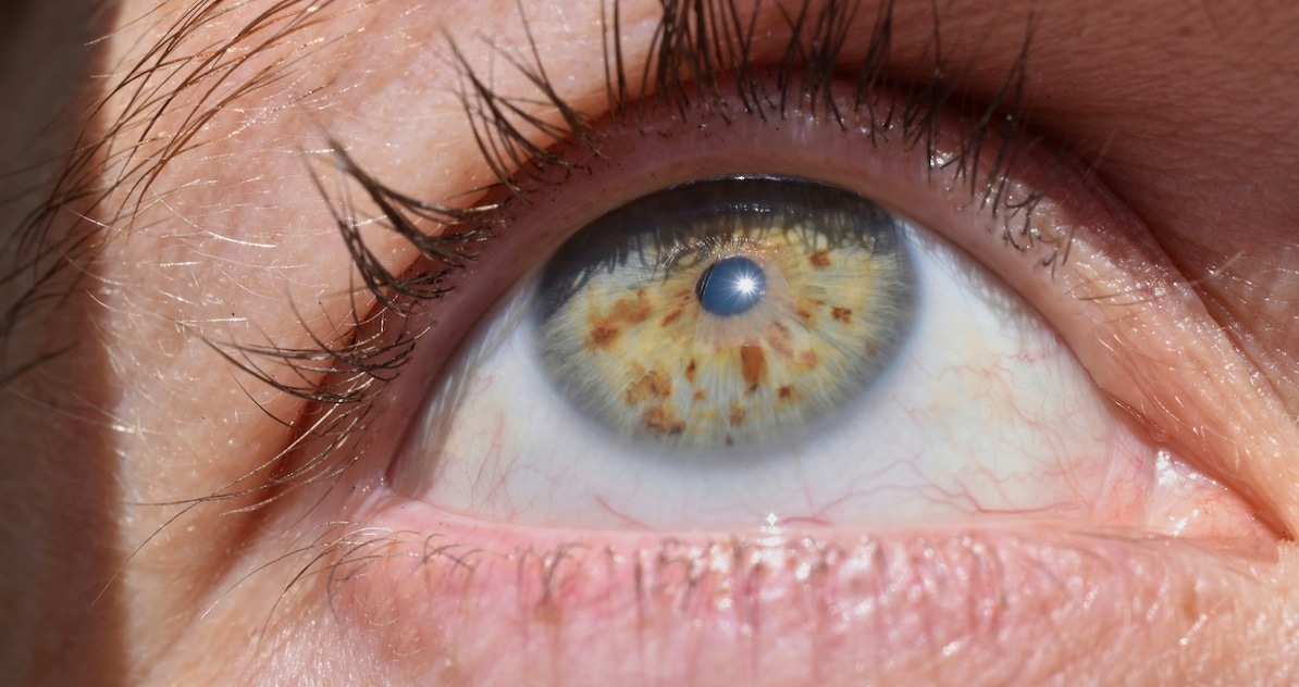 Ontstoken oog? Oma weet raad | Vitamines